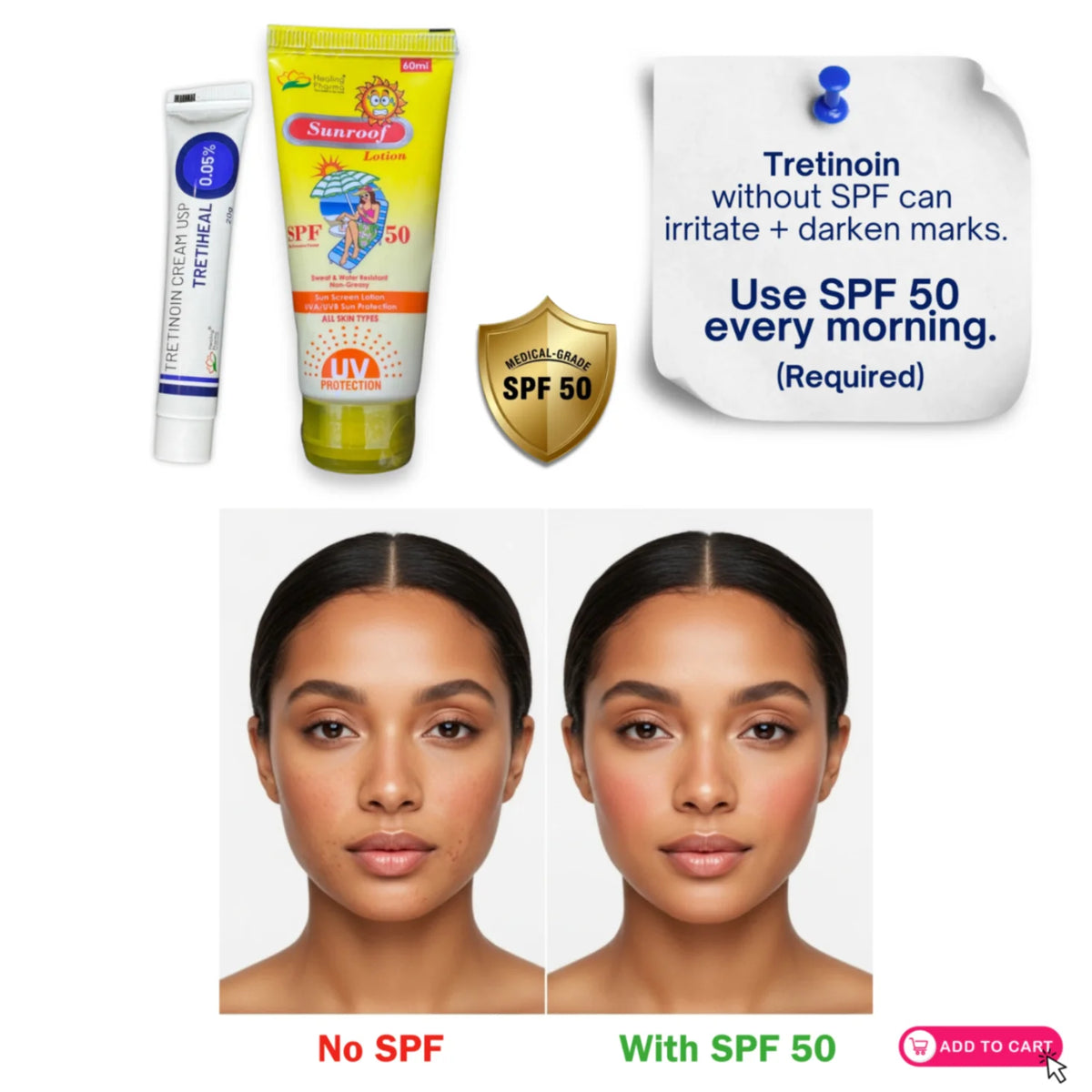 Tretiheal Tretinoin Cream 0.05% - Acne & Anti-Aging Solution | Tretinoins
